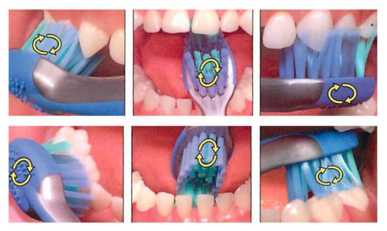 Toothbrushing tips for children - Pediatric Dentistry